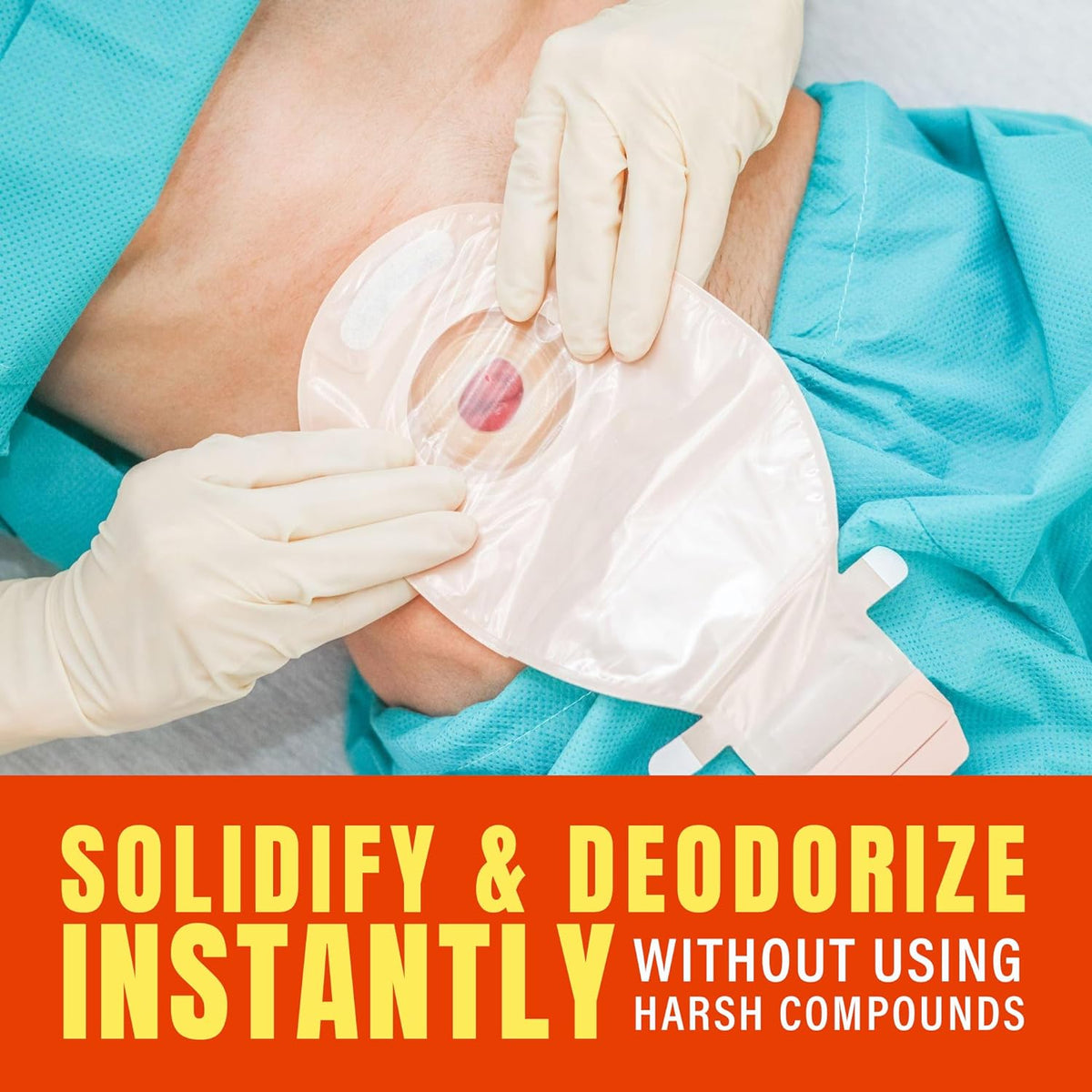 Smelleze® Ostomy Odor Eliminator Granules | NoOdor.com – NoOdor.com